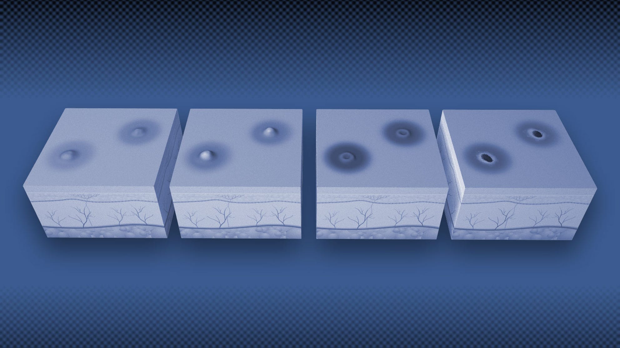 What does monkeypox rash look like? A visual guide to how it spreads