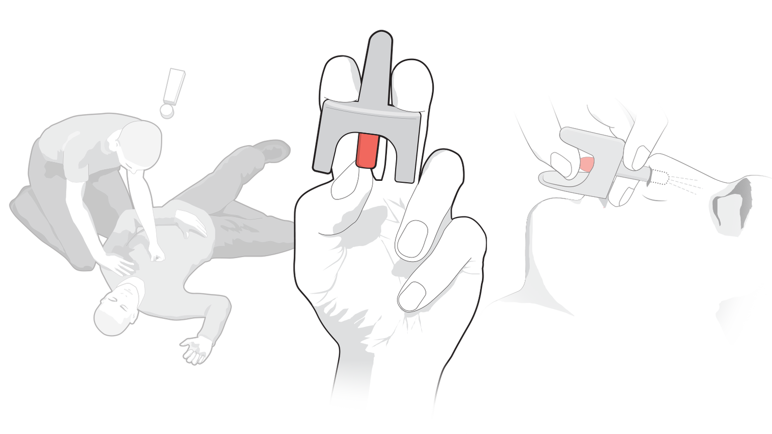 Fentanyl overdoses are rising: A visual guide to using Narcan Fentanyl overdoses are rising: A visual guide to using Narcan