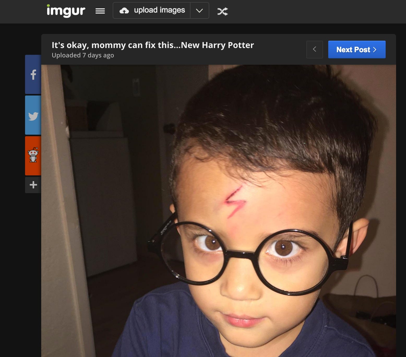 Mom turns boy's forehead cut into Harry Potter-themed scar | 11alive.com