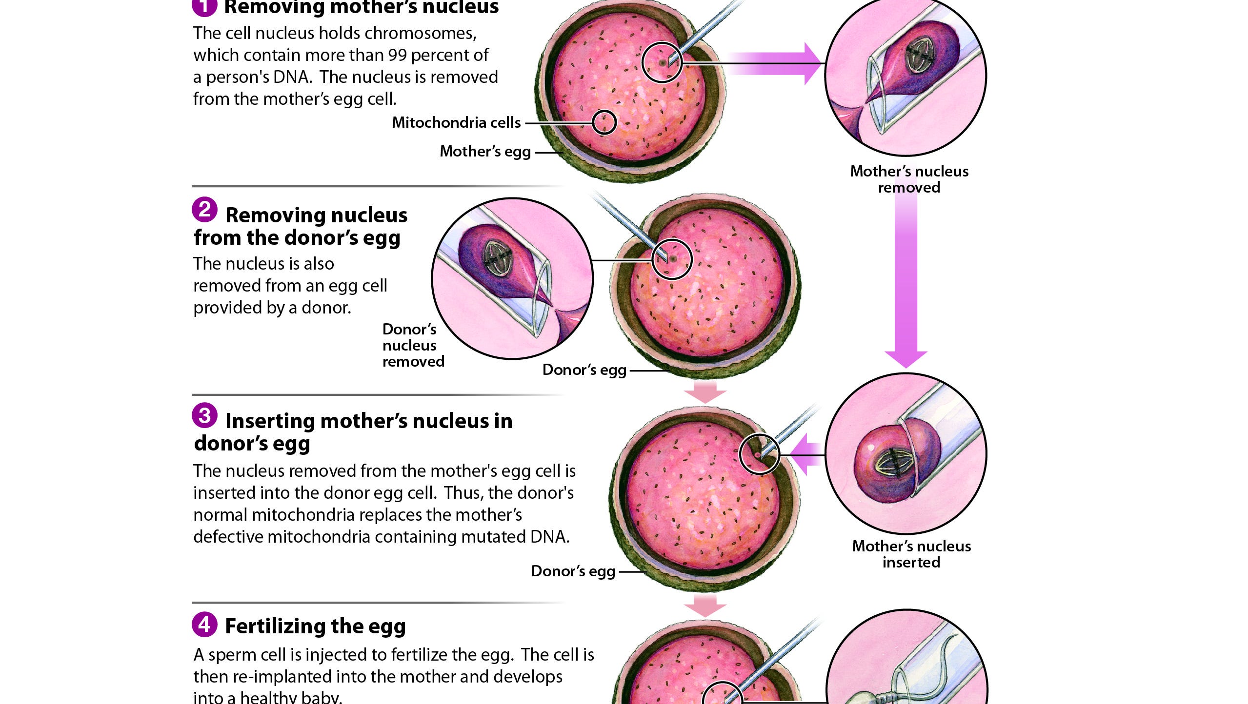 Three-parent fertility method could remove gene defects