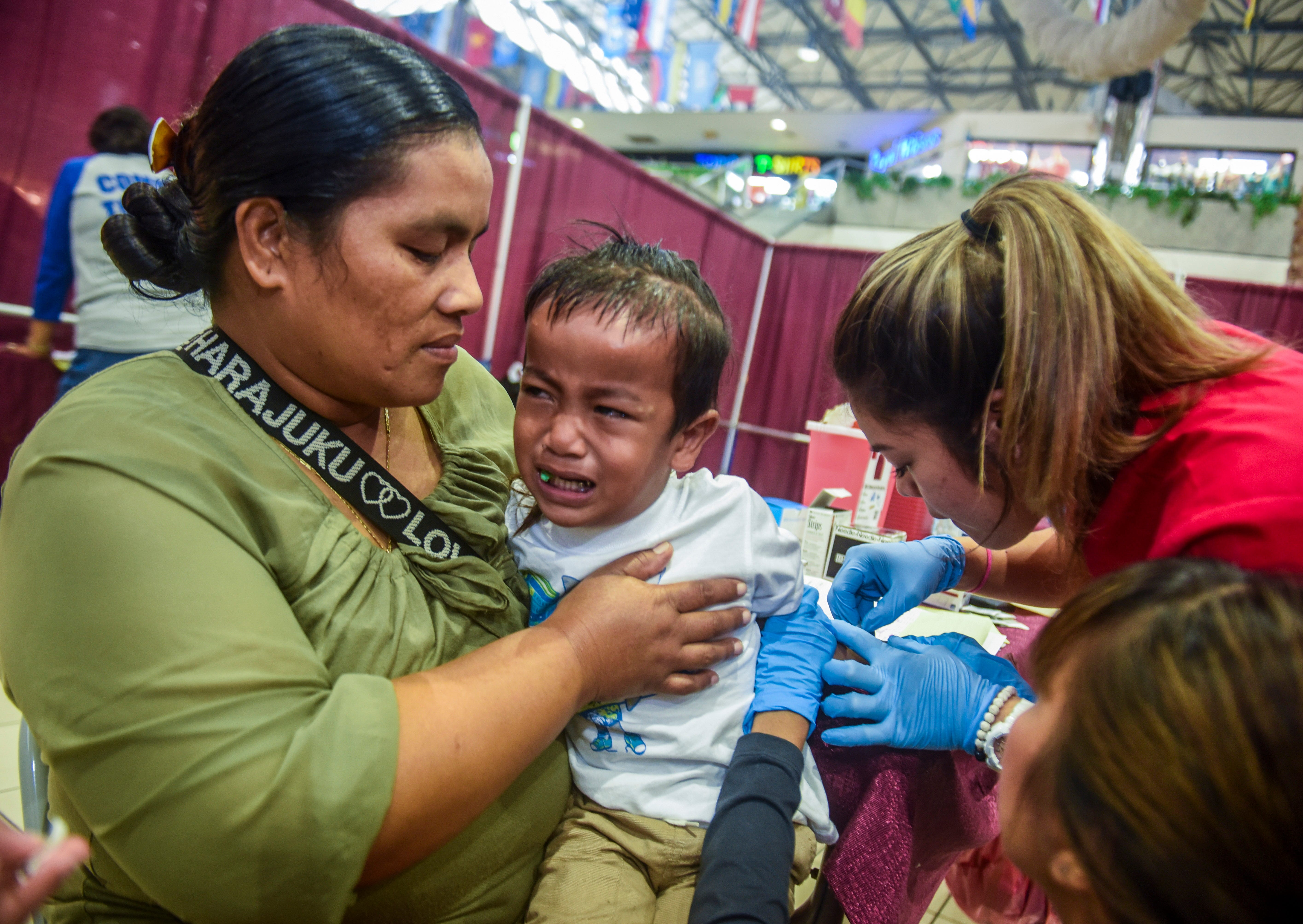 Measles: How to stay safe and what to do if exposed