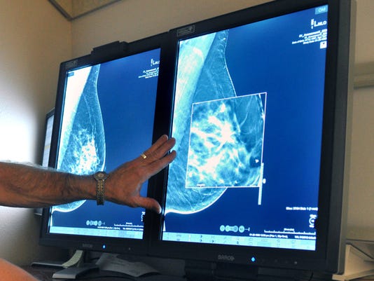 Breast cancer screenings: Should women get a 3D mammogram?