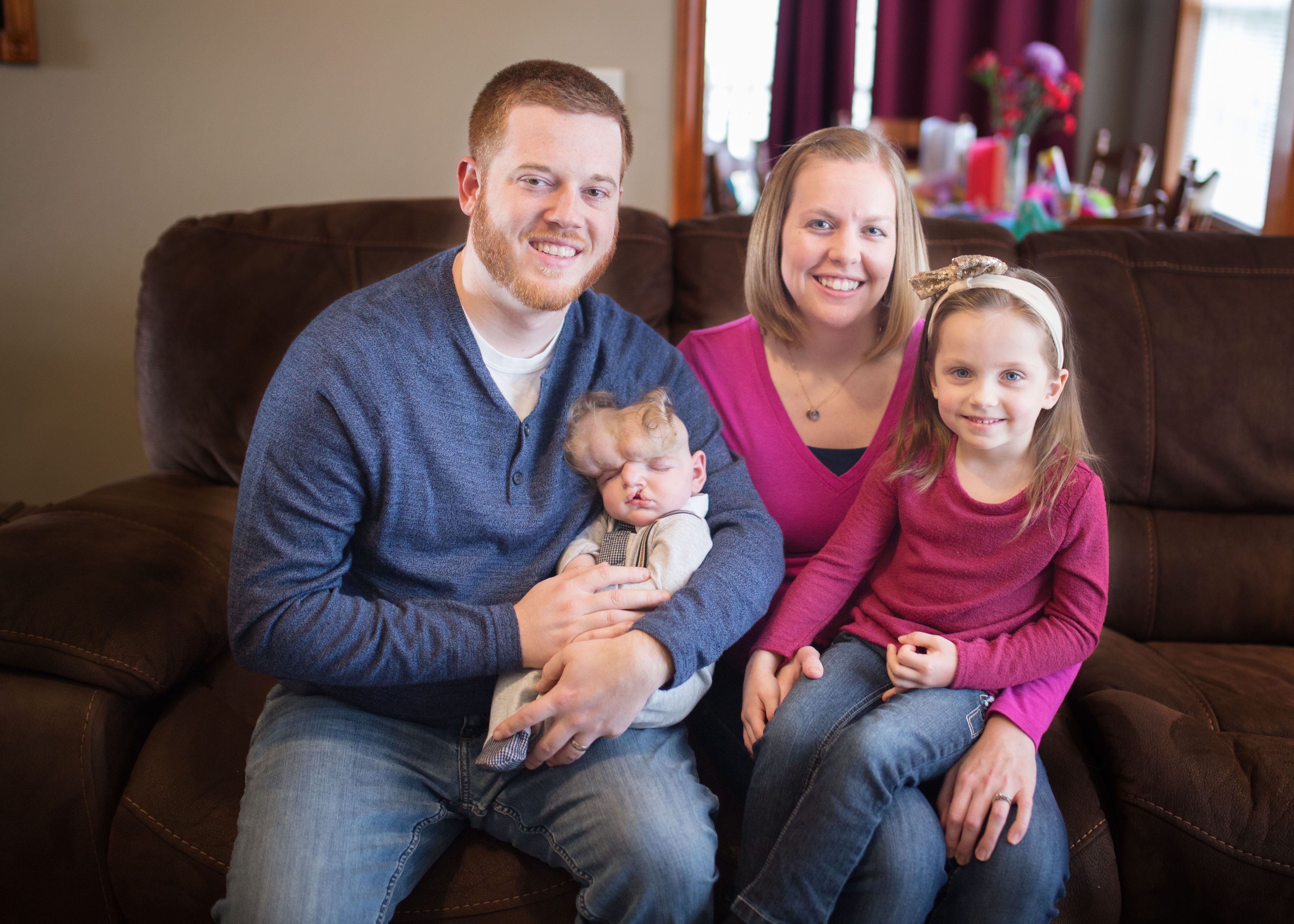 Baby born with no skull continues to amaze family, doctors