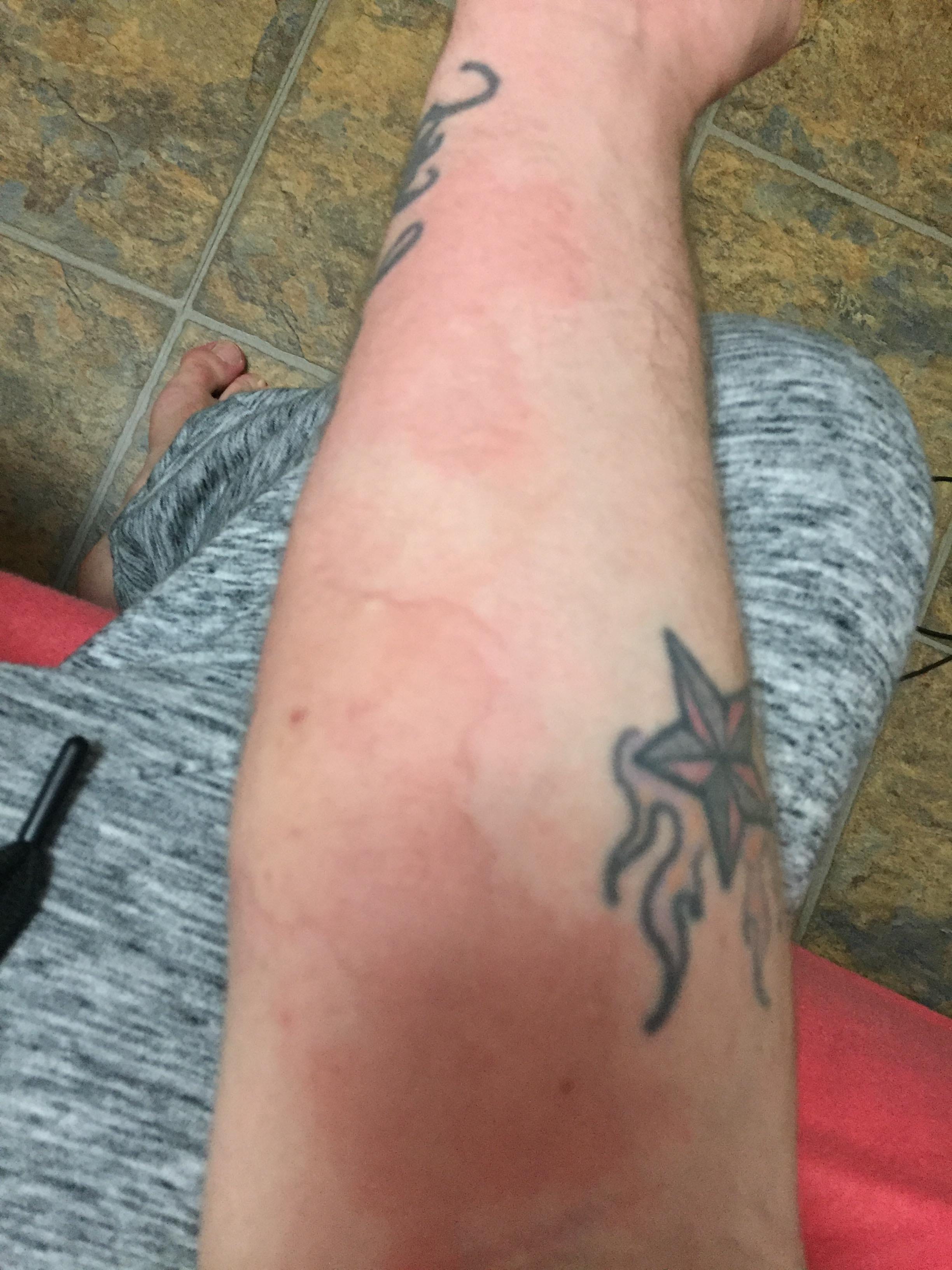 Meth seizures total more than heroin. Its effect on victims is brutal