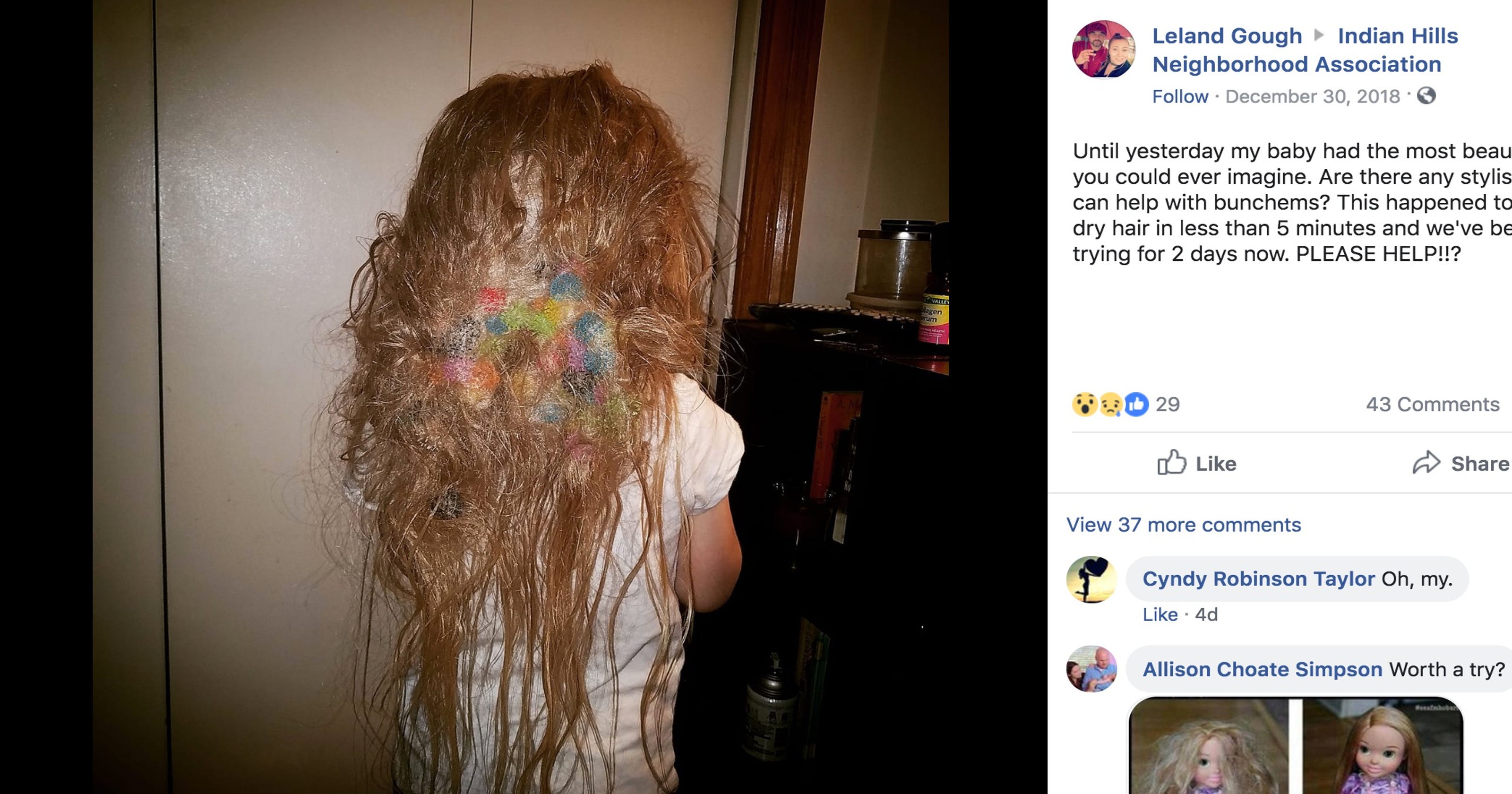 Over 50 Bunchems tangled in hair: Arkansas mom warns parents about toy