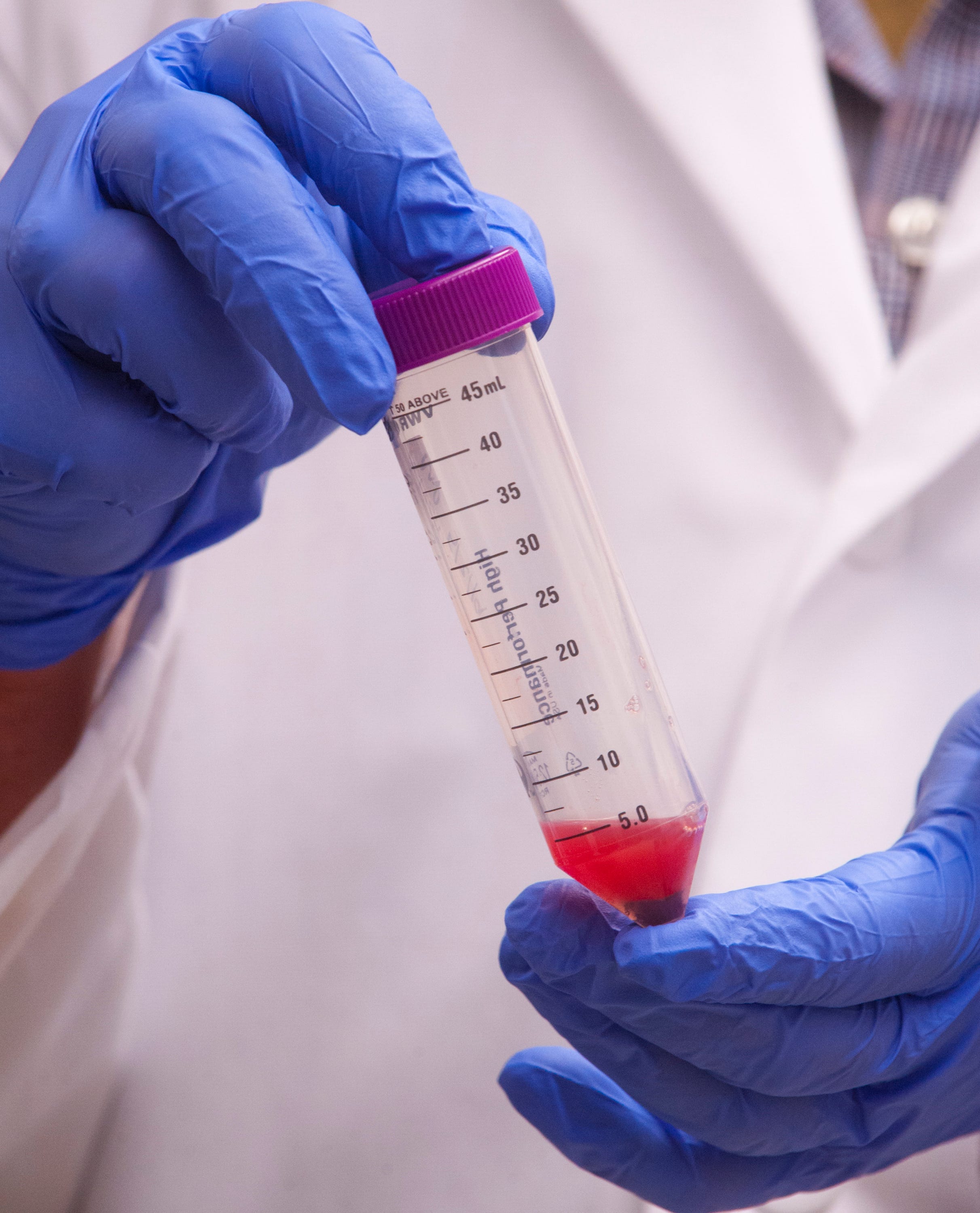 University of Louisville researchers develop freeze-dried blood