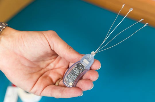 New hope for Wisconsin teen and others with irritable bowel syndrome