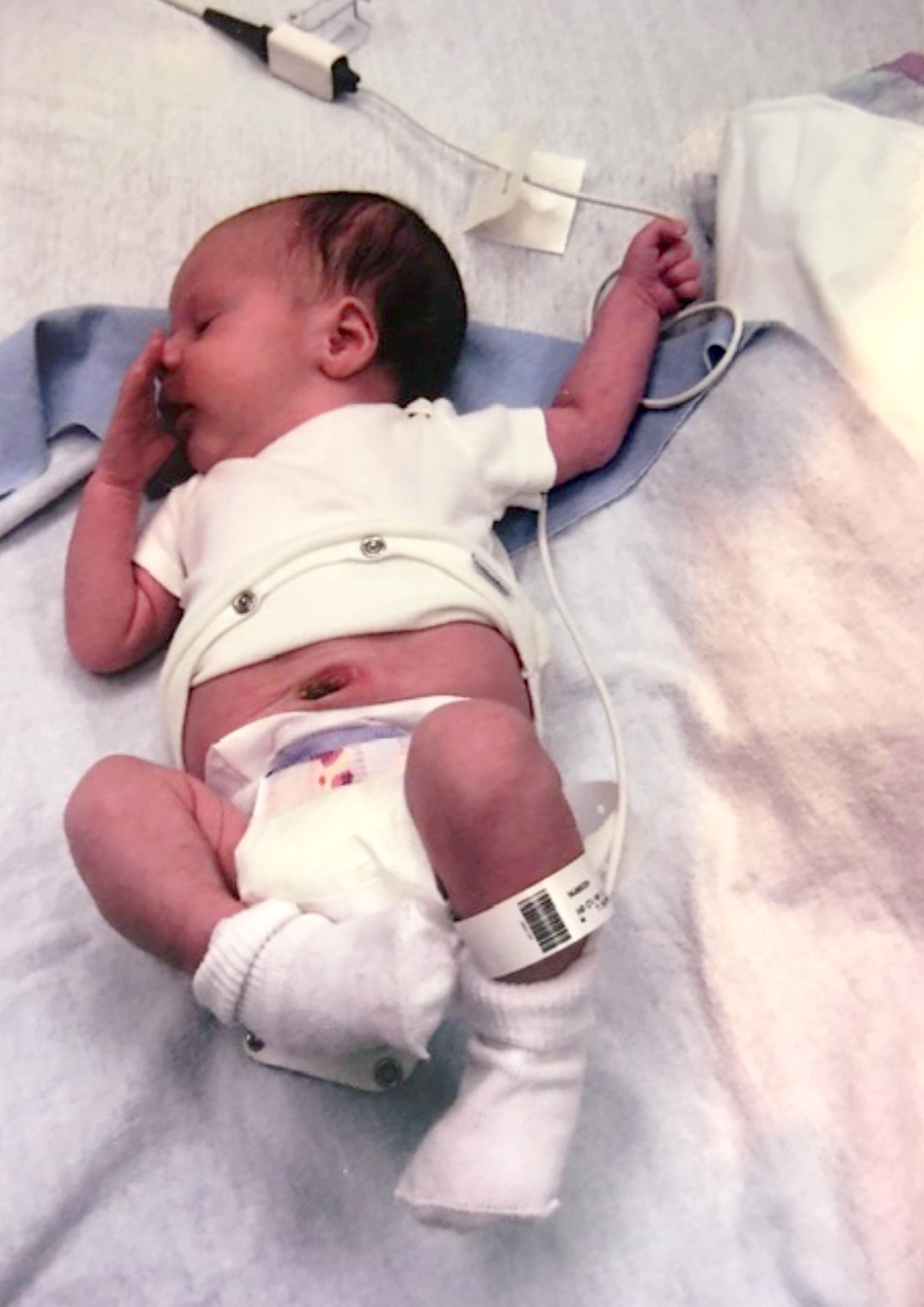 Bubble boy syndrome: Wisconsin SCID test requirement now in 50 states