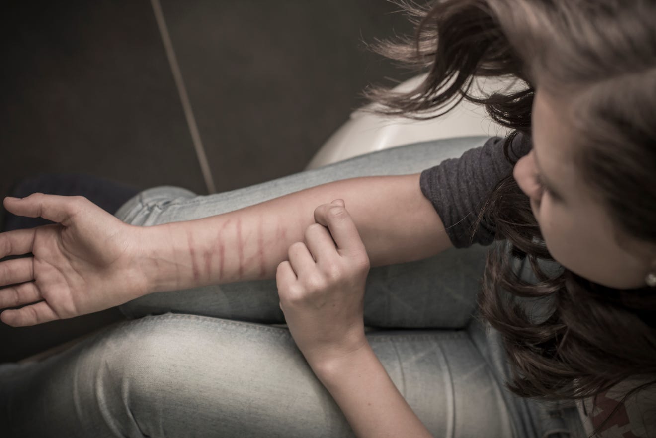 Self harm Isn t Necessarily An Attempt At Suicide It Is A Cry For Help self-harm-isn-t-necessarily-an-attempt-at-suicide-it-is-a-cry-for-help