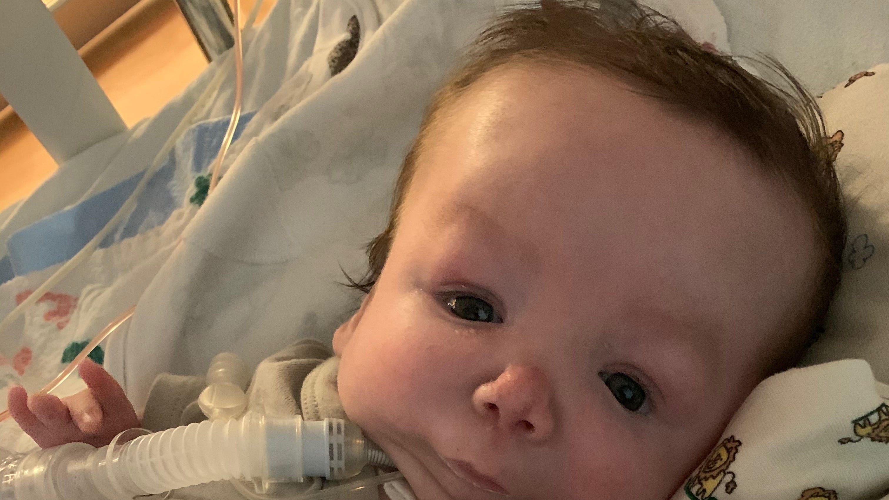 Home For The Holidays Baby Born With Rare Genetic Disorder home-for-the-holidays-baby-born-with-rare-genetic-disorder