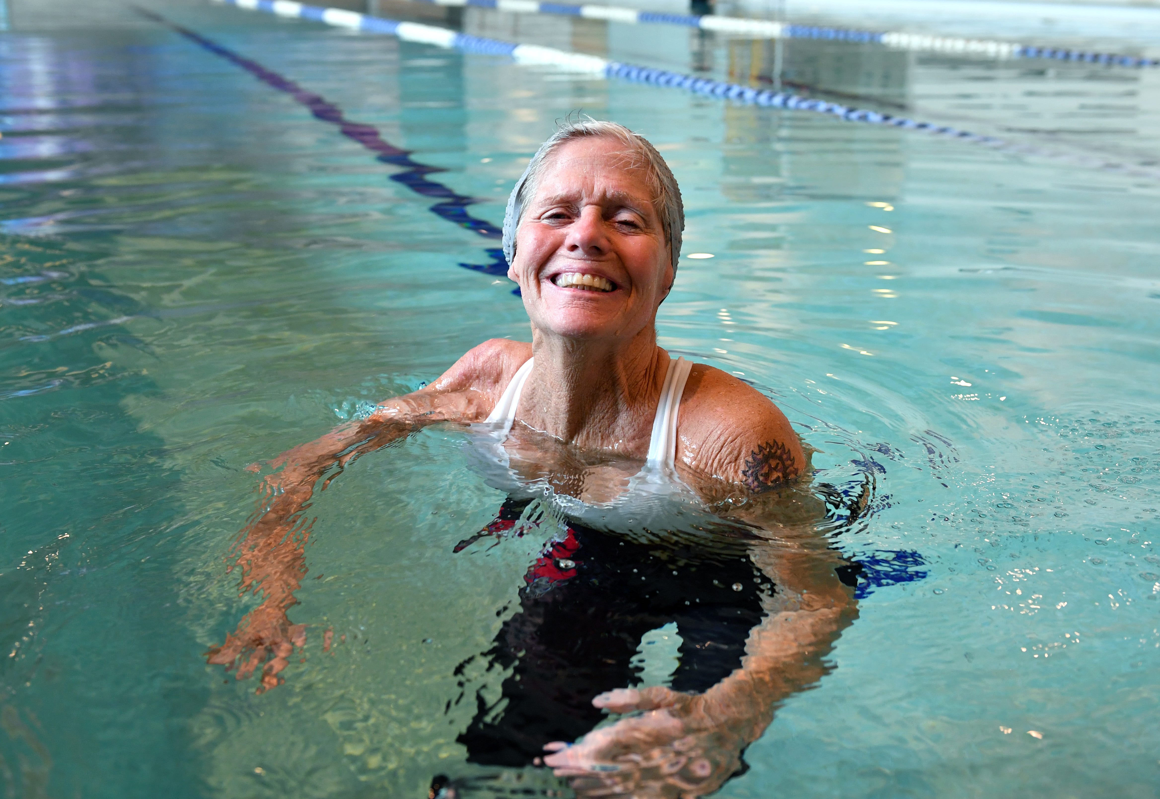 Bucs fan, a polio survivor, swims a mile every day and needs a new leg ...