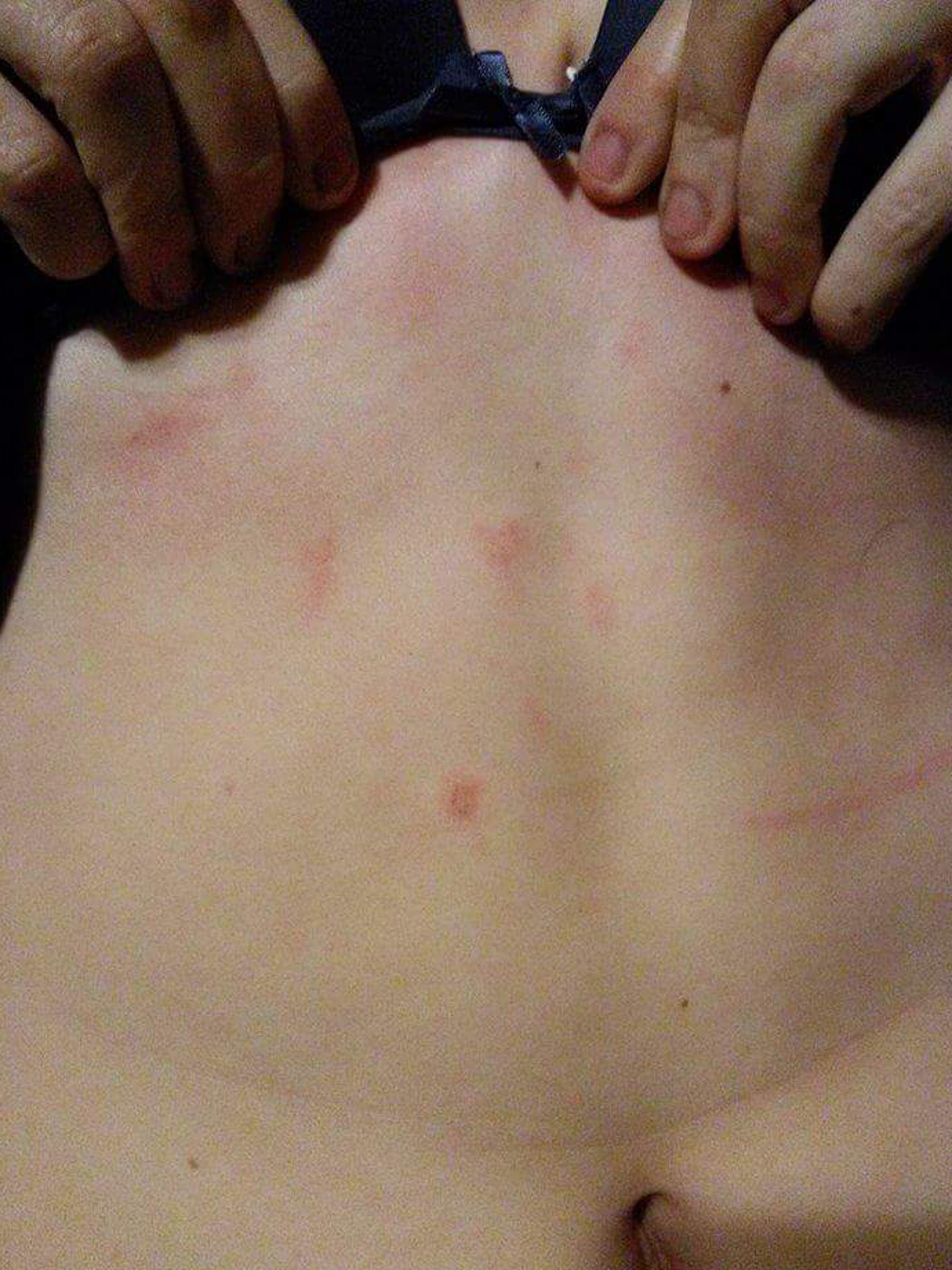 Police use Taser on girl having seizure at Kevin Gates concert