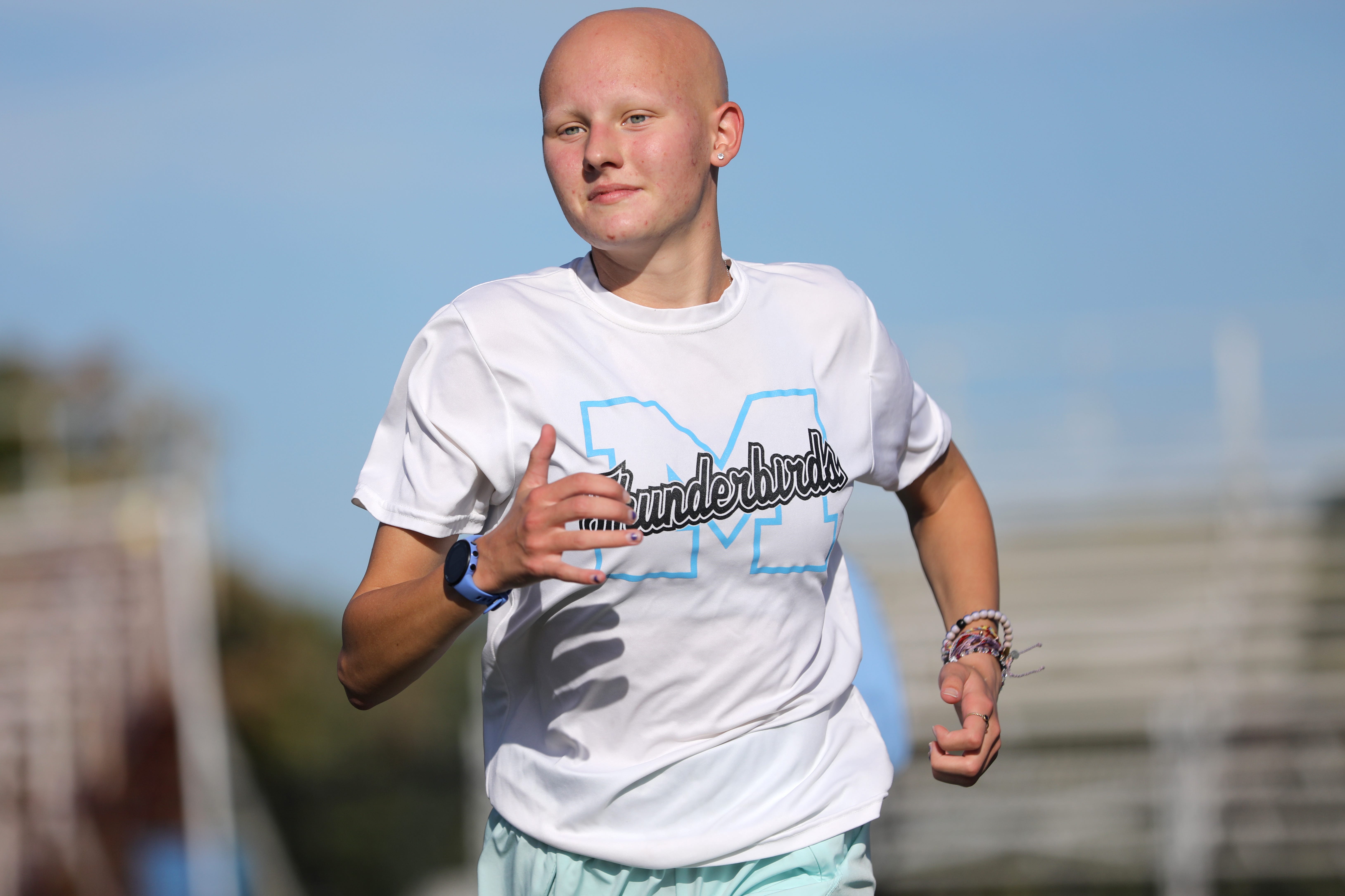 Zoe Merryman: Mahwah XC runner with alopecia finding herself