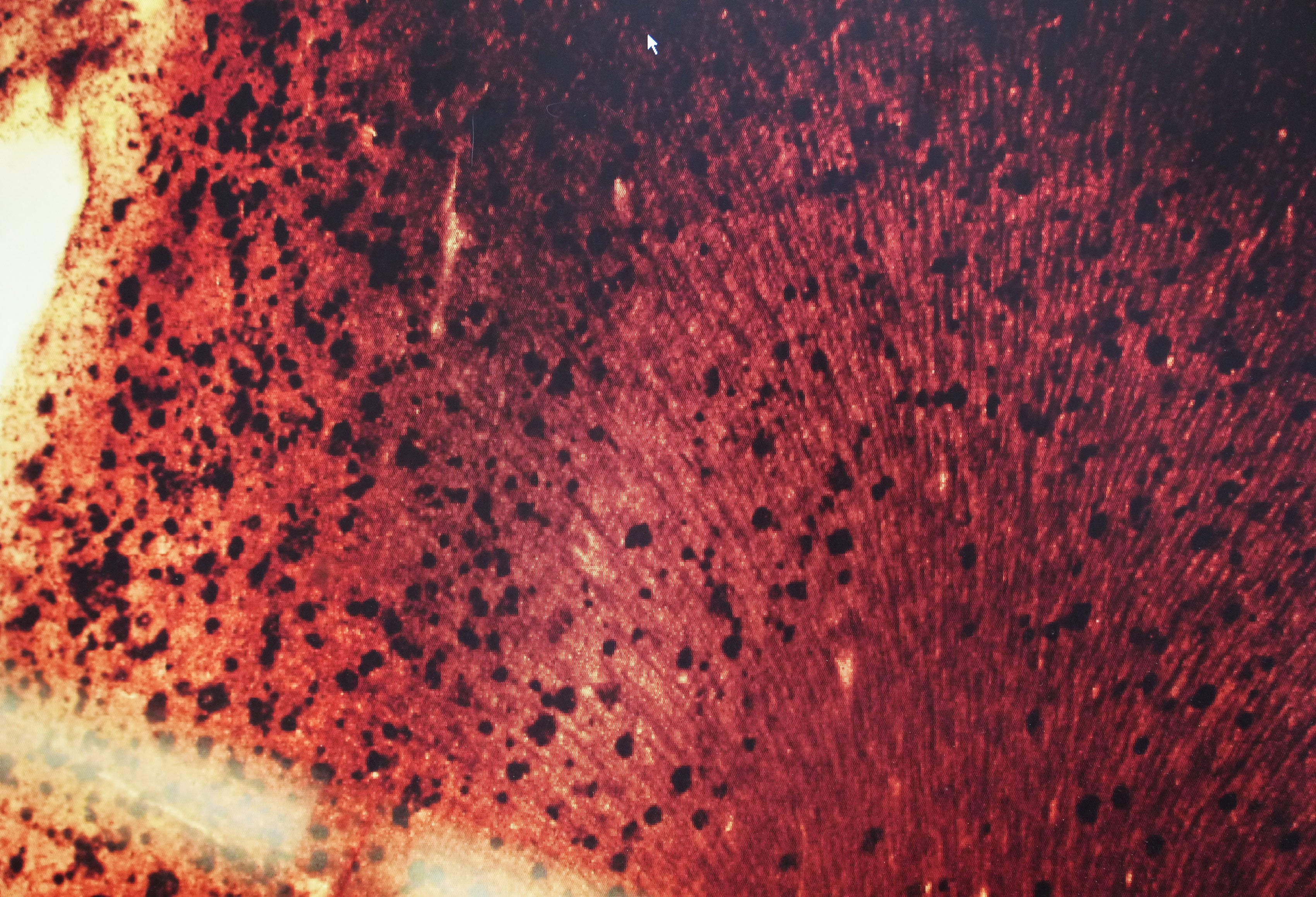 Why dementia is difficult to diagnose and even harder to study