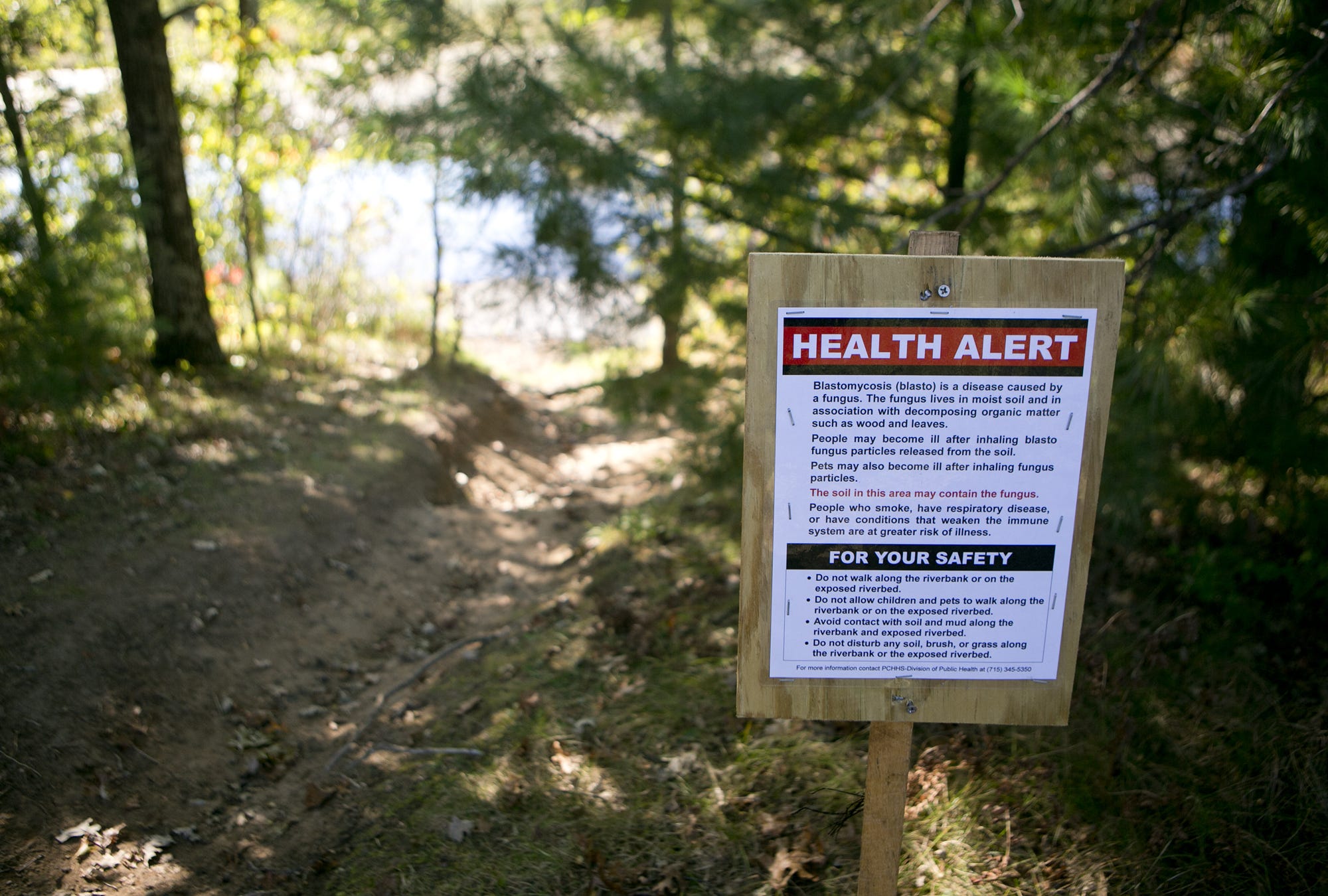 Wisconsin monitors blastomycosis outbreak at Escanaba paper mill